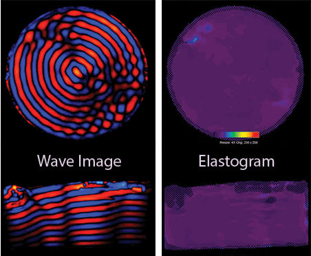 MR Elastography - Telemed Solutions